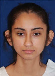 Ear Surgery | Otoplasty | Kawartha Plastic Surgery